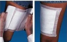 GAUZE, BORDER 6X6 (30/CS) - New Hampshire Medical Supply